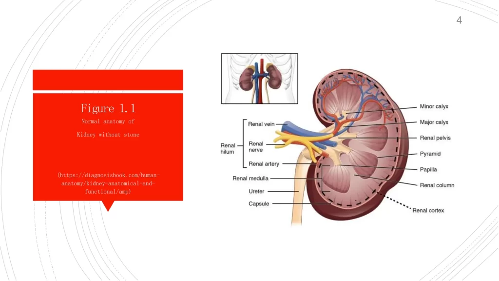 Kidney Stones 2026 PowerPoint Presentation - PPT & PDF File